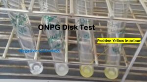 ONPG Test : Introduction, Principle,Test Requirements,Procedure