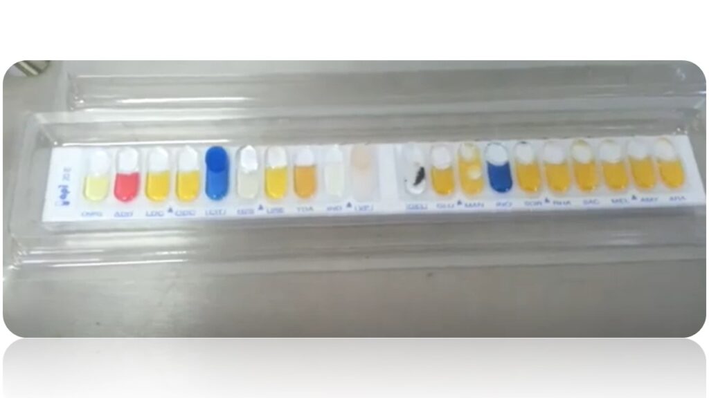 API Test For Bacteria Introduction Principle Test Requirements