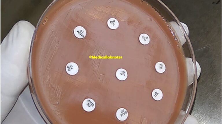 AST Pattern of Bacteria: Introduction, Group of AST Pattern, List of