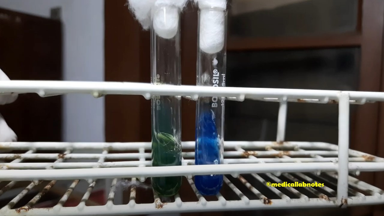 Gram Negative Bacteria Biochemical Test: Table, Introduction, Com