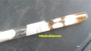Dermatophyte Test Medium (DTM): Introduction, Composition