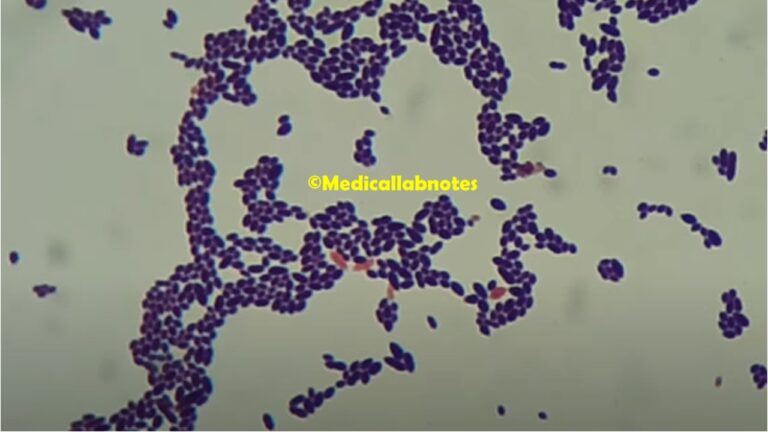 LAP (Leucine Aminopeptidase) Test: Introduction, Principle, Test