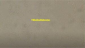 LAP (Leucine Aminopeptidase) Test: Introduction, Principle, Test