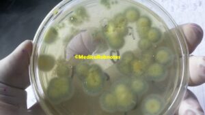 Potato Dextrose Agar (PDA): Introduction, Composition, Principle