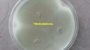 Potato Dextrose Agar (PDA): Introduction, Composition, Principle