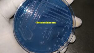 Microbiology Reporting Methods: Introduction, List of Templates