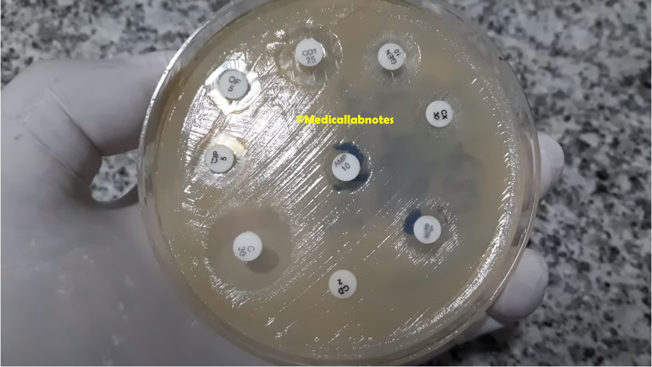 AST Pattern of Bacteria: Introduction, Group of AST Pattern, List of
