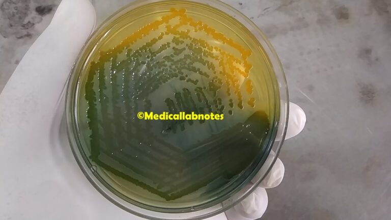 TCBS Agar : Introduction, Composition,Principle, Test Requirement