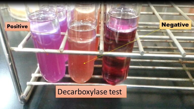 Decarboxylase Test: Introduction, Principle, Test Requirements