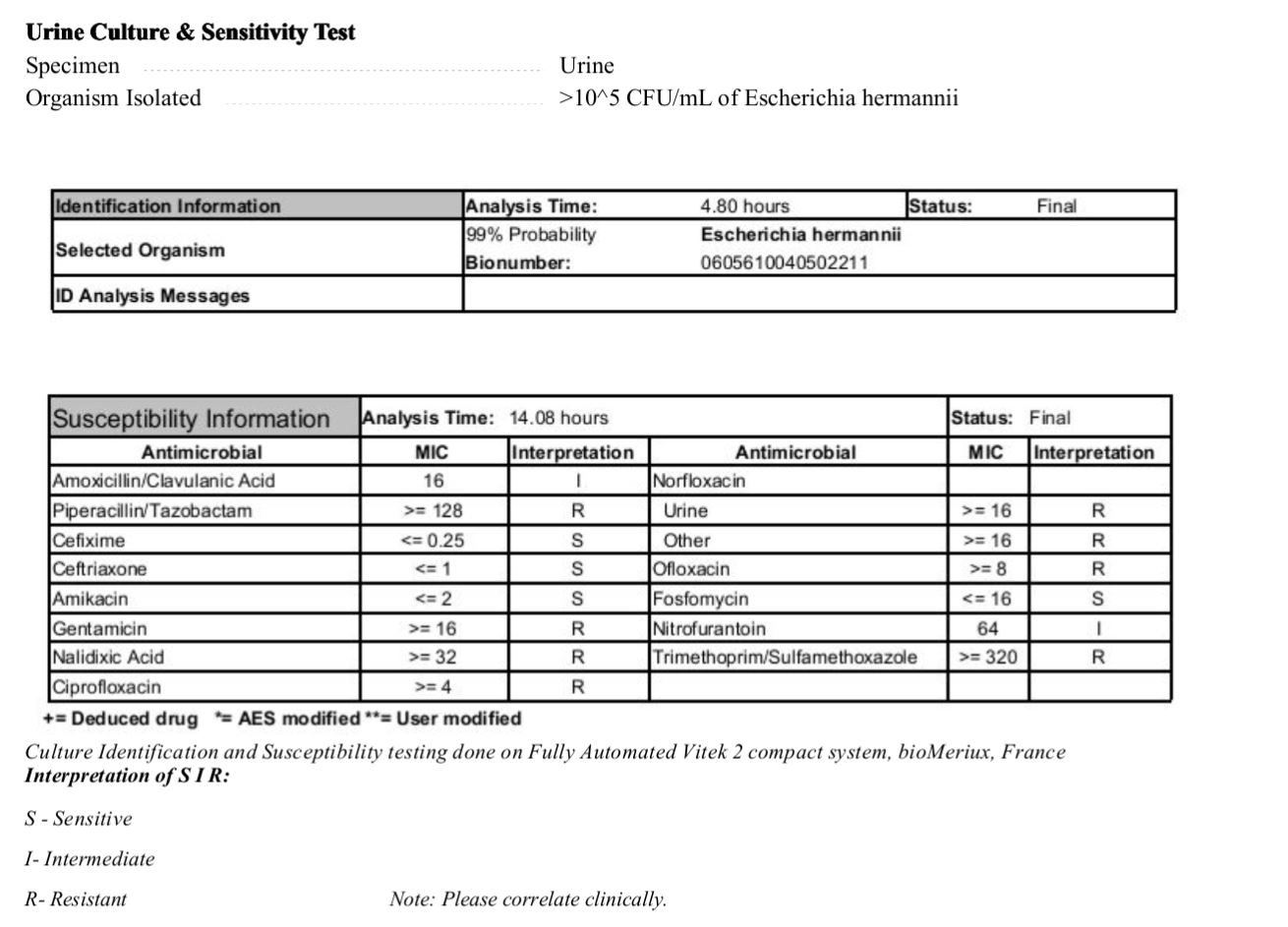Escherichia hermanii: Introduction, Classification, Pathogenecity,