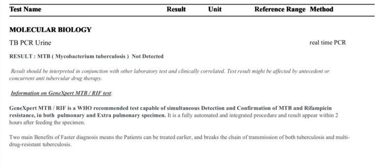 GeneXpert Test For Tuberculosis: Introduction, Principle, Test