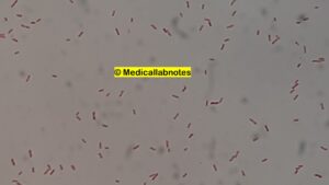 Burkholderia cepacia: Introduction, Morphology, Pathogenicity