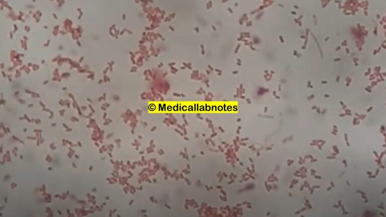 Shigella sonnei: Introduction, Morphology, Pathogenicity, Lab