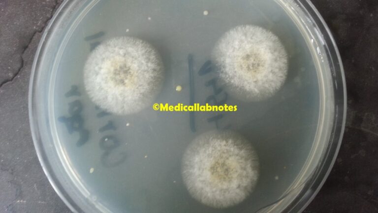 Aspergillus flavus: Introduction, Morphology, Pathogenicity, Lab