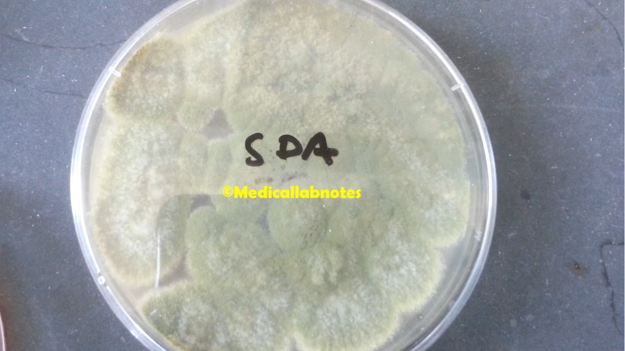 Aspergillus fumigatus: Introduction, Morphology, Pathogenicity, Lab