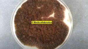 Aspergillus niger: Introduction, Morphology, Pathogenicity, Lab