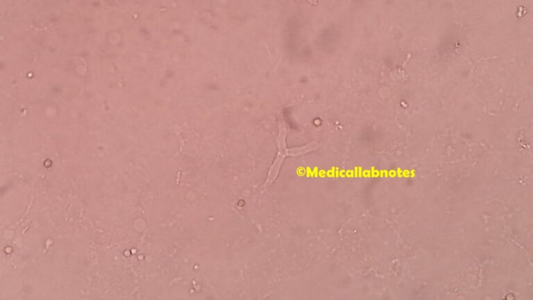 Aspergillus fumigatus: Introduction, Morphology, Pathogenicity, Lab