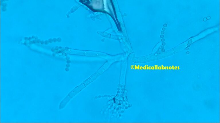 Aspergillus flavus: Introduction, Morphology, Pathogenicity, Lab