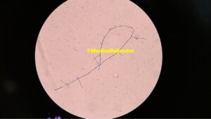 Sporothrix schenckii: Introduction, Morphology, Pathogenicity, Lab
