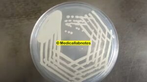 Candida: Introduction, Morphology, Pathogenicity, Lab Diagnosis