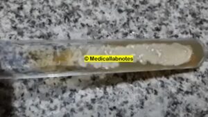 Candida albicans: Introduction, Morphology, Pathogenicity, Lab