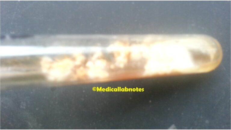 Fusarium solani: Introduction, Morphology, Pathogenicity, Lab