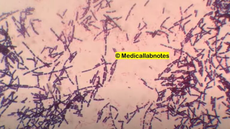 Bacillus: Introduction, Morphology, Pathogenicity, Lab Diagnosis