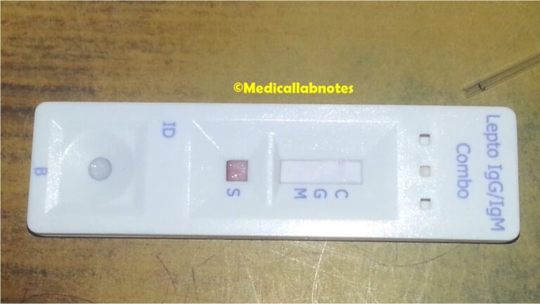Leptospira IgM and IgG Test: Introduction, Test Result, Test