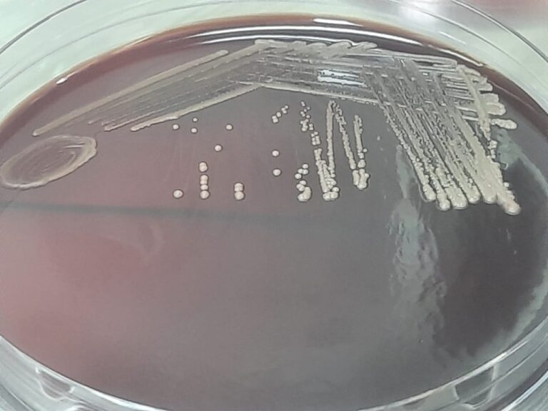 Malassezia: Introduction, Morphology, Pathogenicity, Lab Diagnosis