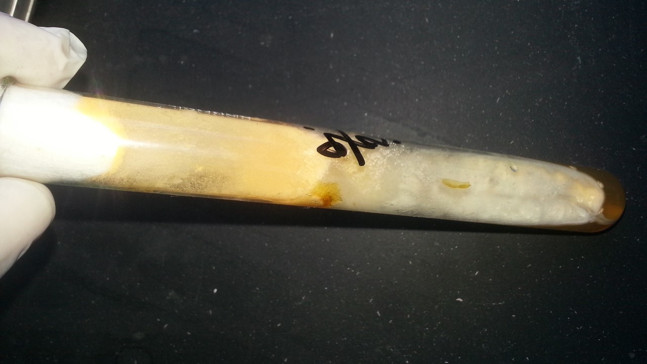 Scopulariopsis: Introduction, Morphology, Pathogenicity, Lab
