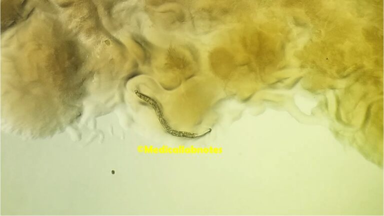 Strongyloides: Introduction, Morphology, Pathogenicity, Lab
