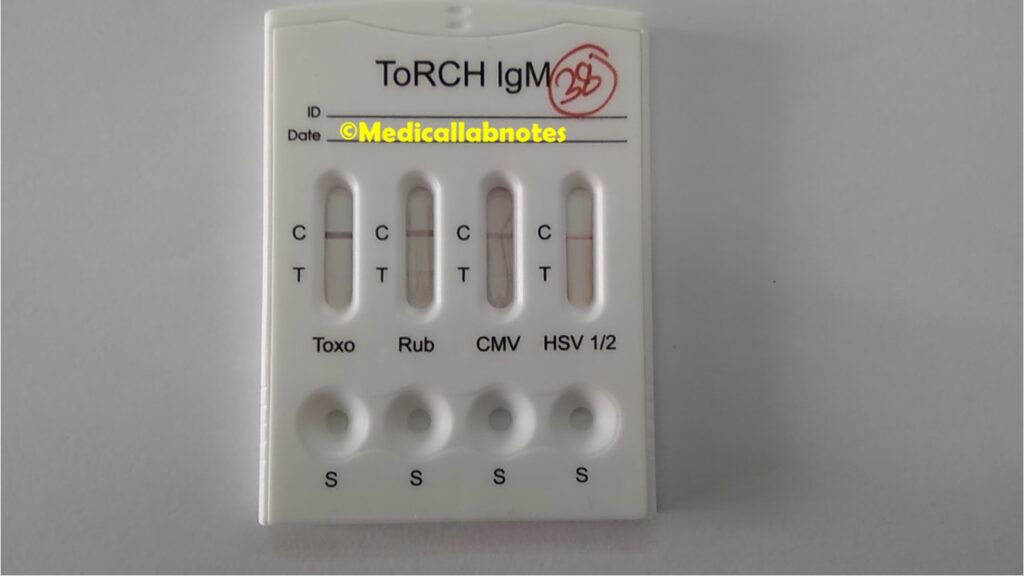 TORCH Panel Introduction Group Of Test Test Device Clinical TORCH Panel Introduction Group Of Test Test Device Clinical