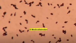 Candida: Introduction, Morphology, Pathogenicity, Lab Diagnosis