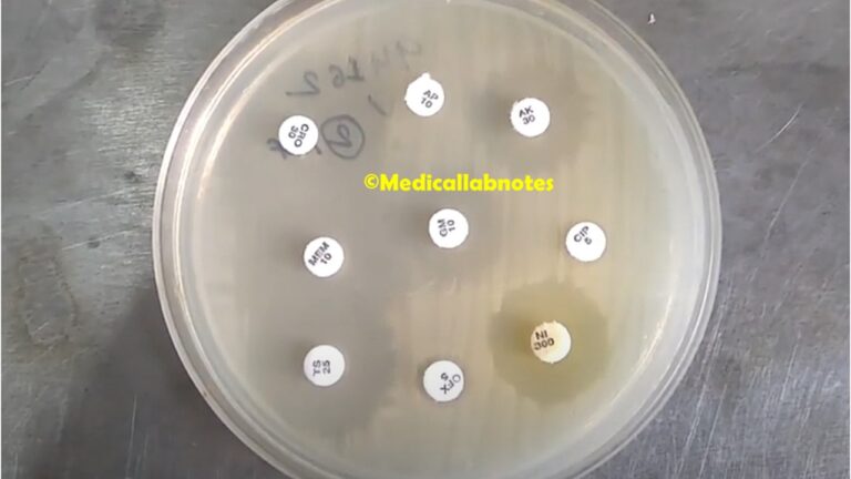 Escherichia coli: Introduction, Morphology, Pathogenicity, Lab