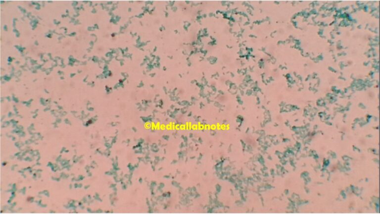 Corynebacterium diphtheriae: Introduction, Morphology, Pathogen