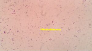 Corynebacterium diphtheriae: Introduction, Morphology, Pathogen