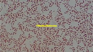 Shewanella: Introduction, Morphology, Pathogenicity, Lab