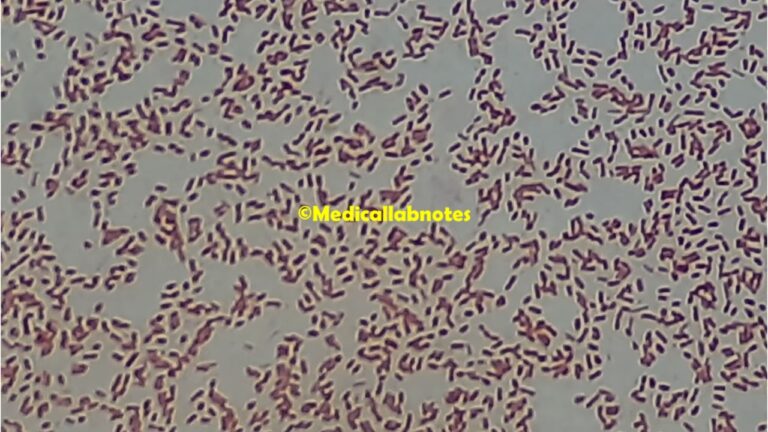 Shewanella: Introduction, Morphology, Pathogenicity, Lab
