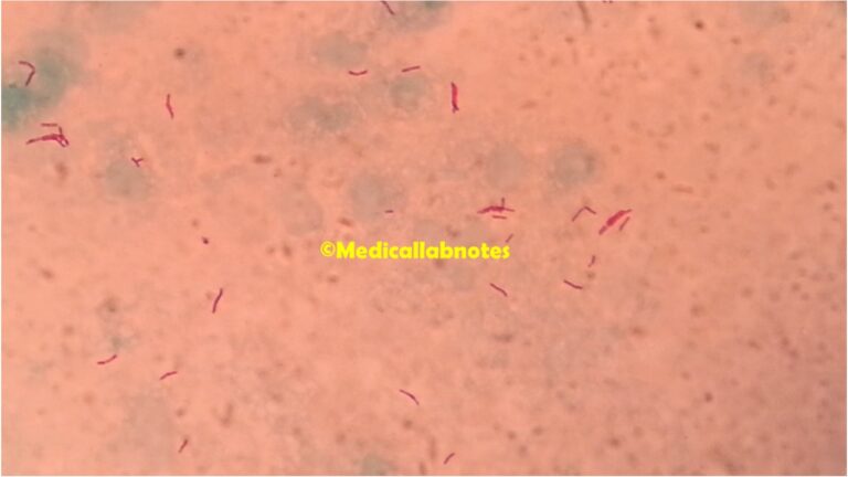 Mycobacterium tuberculosis: Introduction, Morphology, Pathogen