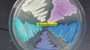 Candida parapsilosis: Introduction, Morphology, Pathogenicity, Lab