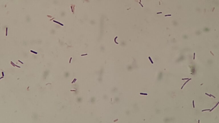 Lactobacillus-Introduction, Morphology, Pathogenicity, Lab Diag