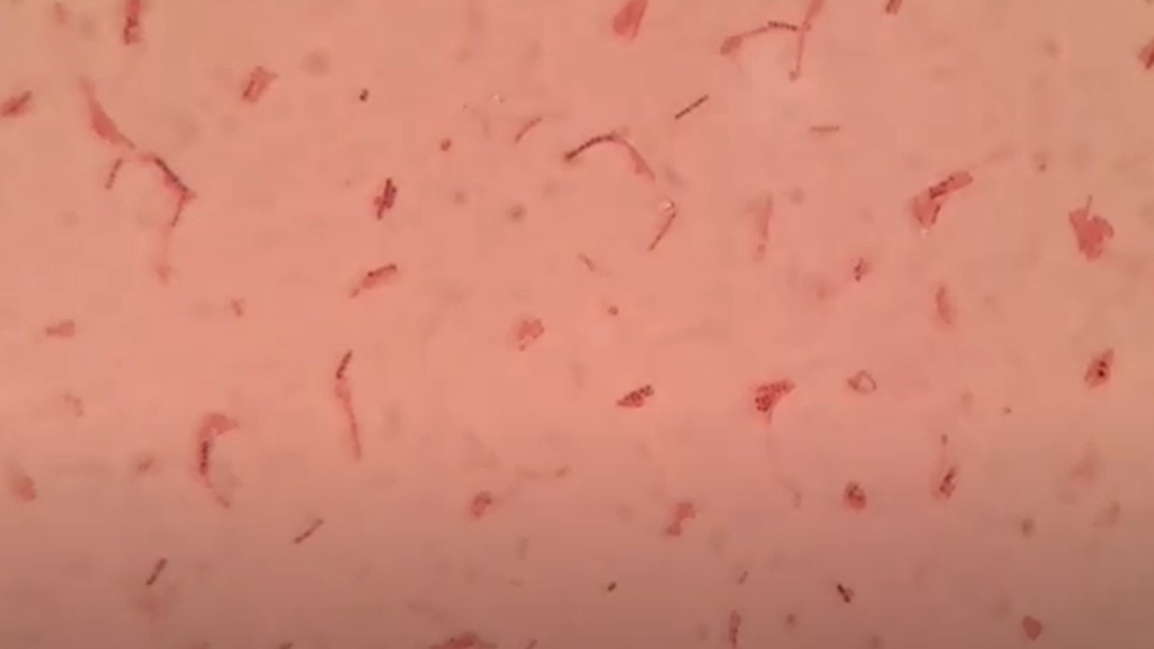 Lactobacillus-Introduction, Morphology, Pathogenicity, Lab Diag