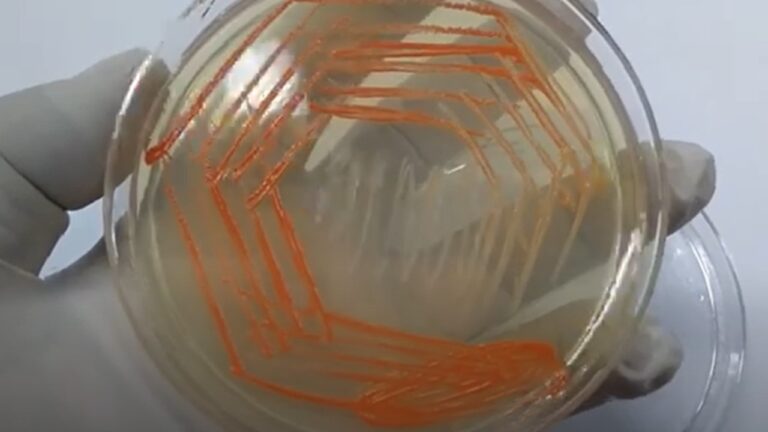 Micrococcus-Introduction, Morphology, Pathogenicity, Lab