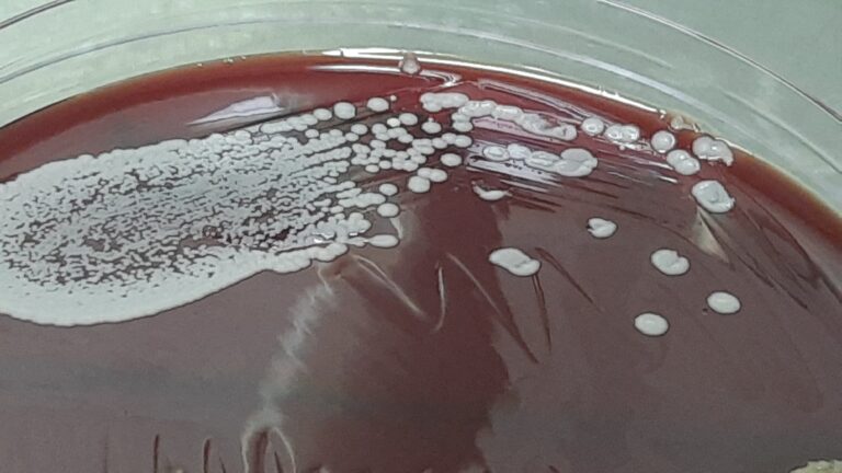 Staphylococcus haemolyticus-Introduction, Morphology, Pathogen