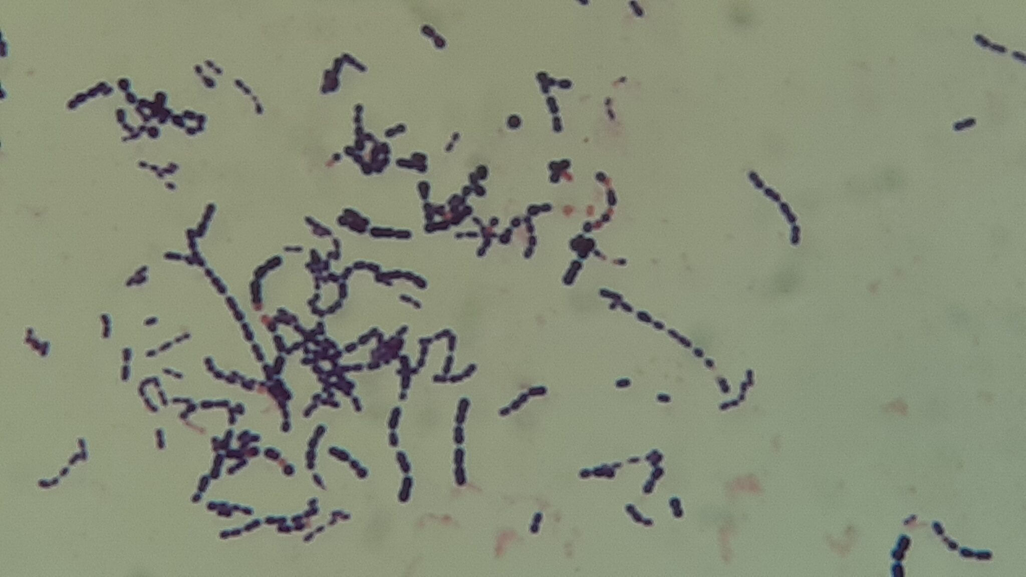 Gemella morbillorum-Introduction, Morphology, Pathogenicity, Lab