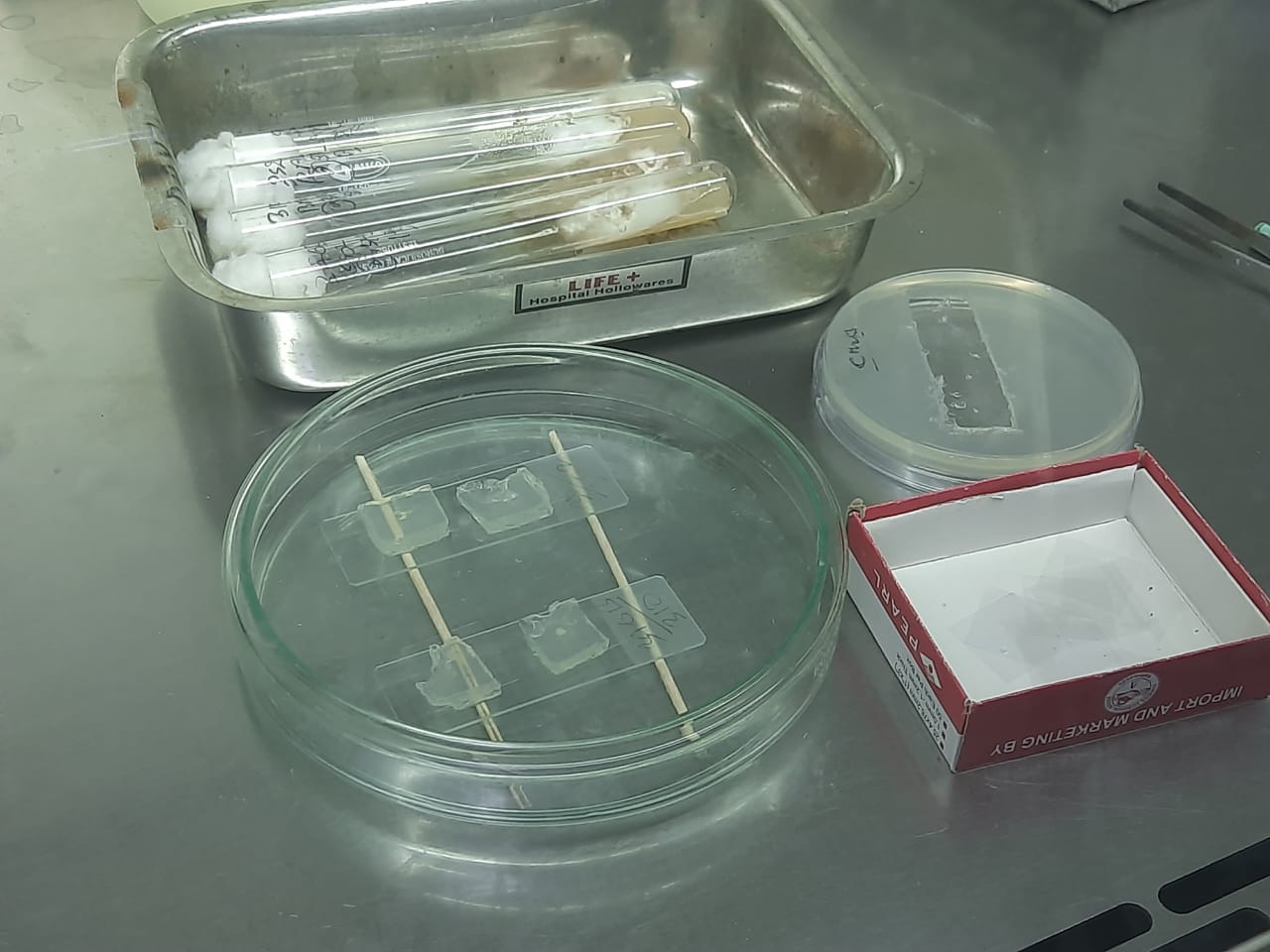 Slide Culture Technique for Fungi- Introduction, Requirement