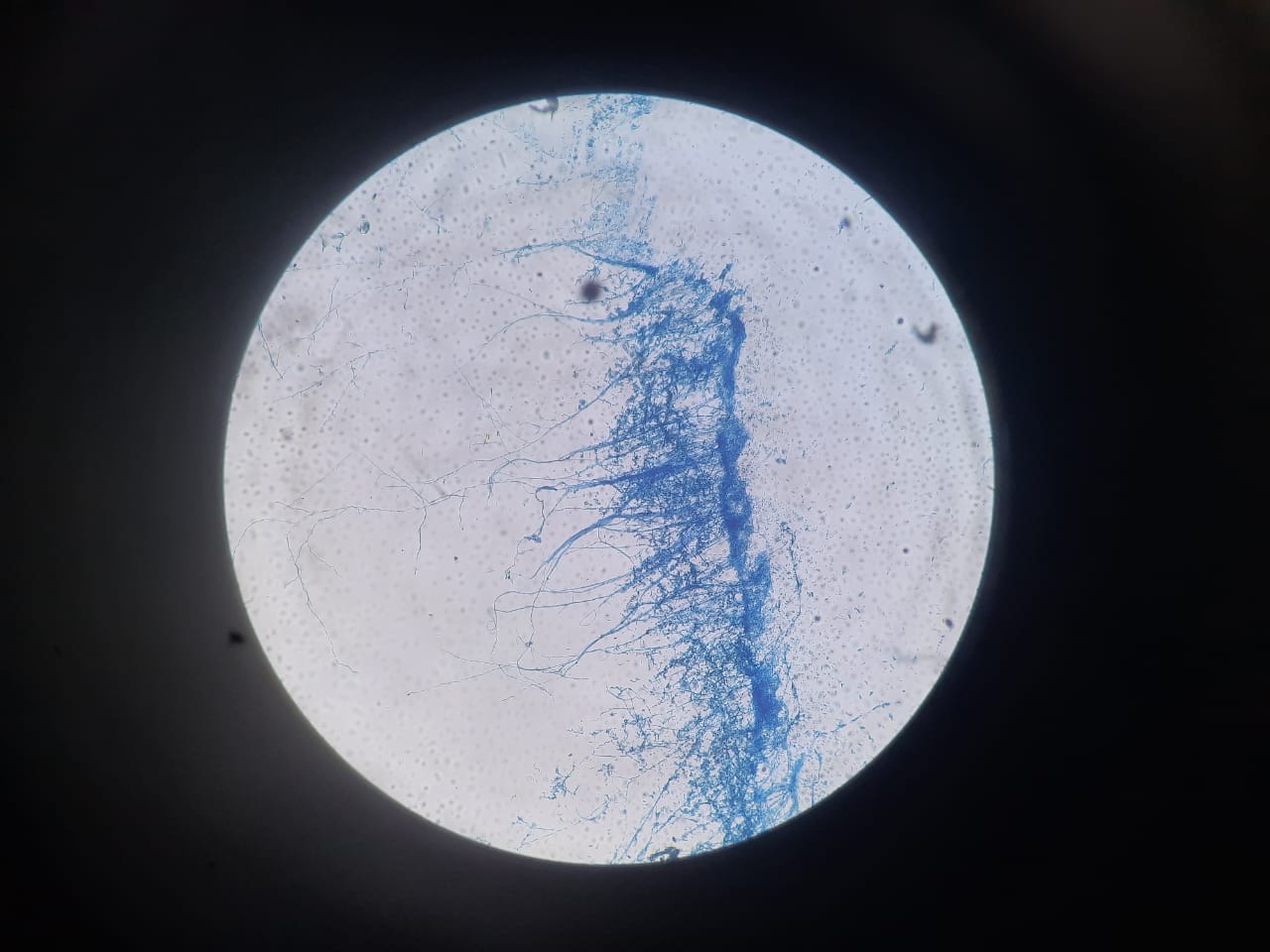 Slide Culture Technique for Fungi- Introduction, Requirement