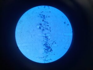 Slide Culture Technique for Fungi- Introduction, Requirement