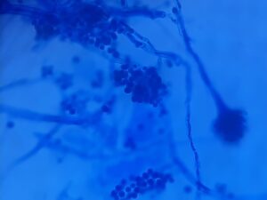 Slide Culture Technique for Fungi- Introduction, Requirement