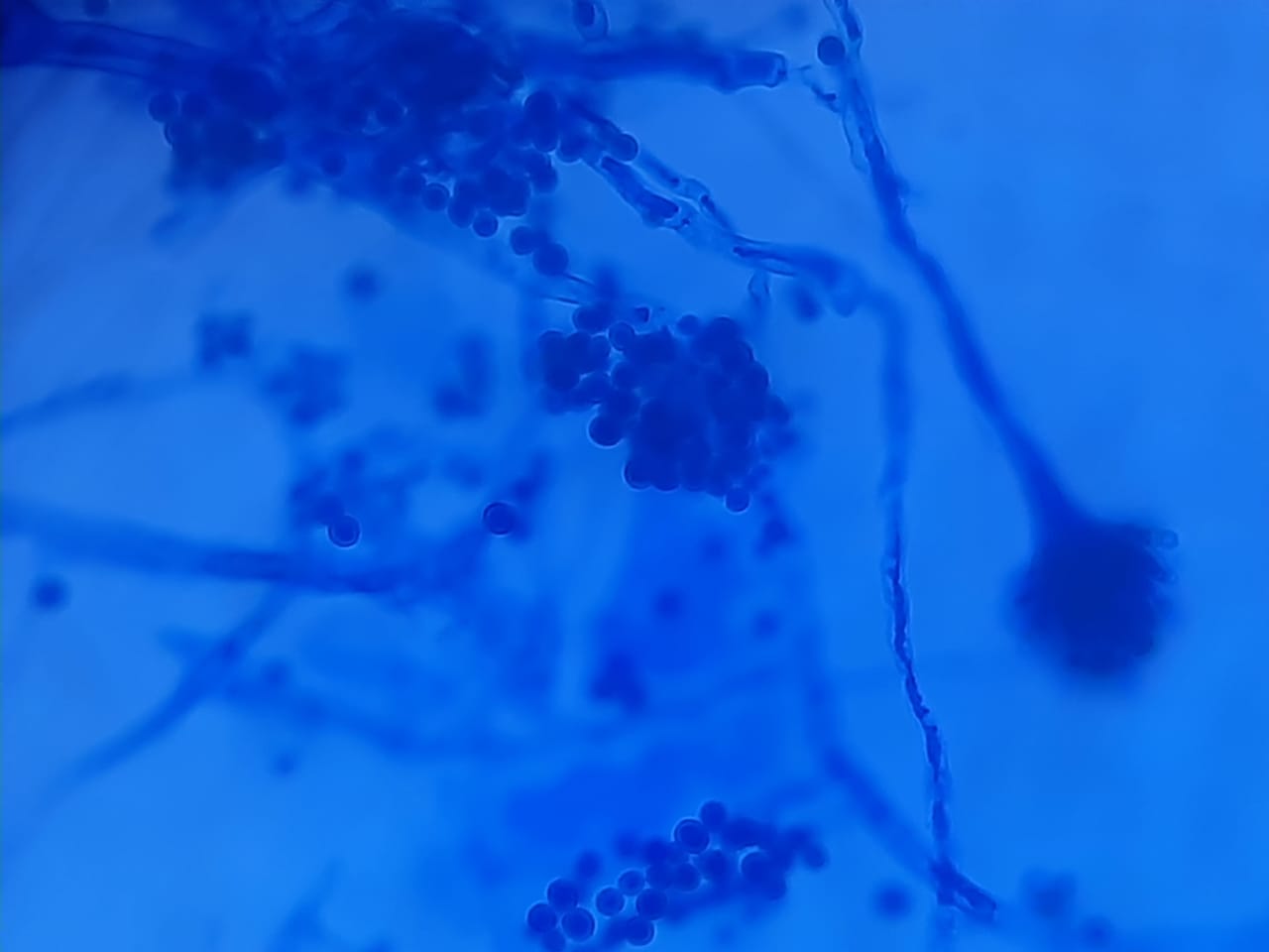 Slide Culture Technique for Fungi- Introduction, Requirement